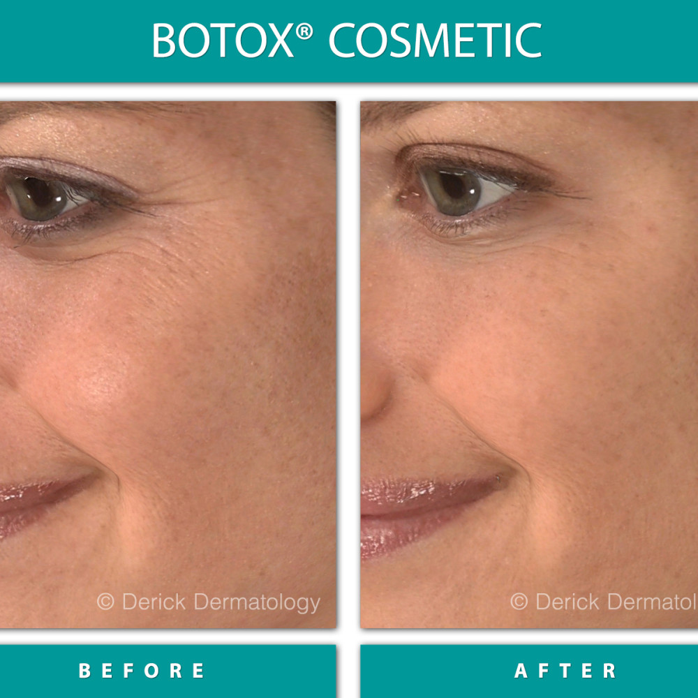 Cosmetic Treatments, Surgery, Procedures | Derick Dermatology