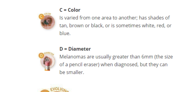 The ABCDEs of Melanoma - Skin Cancer - Derick Dermatology